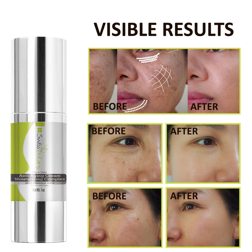 Anti Aging Cream Moisturizing Face Complex with Matrixyl 3000 – swissbotany